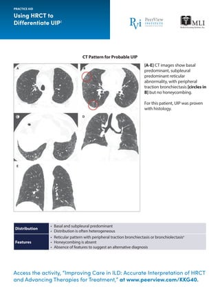 Improving Care in ILD: Accurate Interpretation of HRCT and Advancing ...