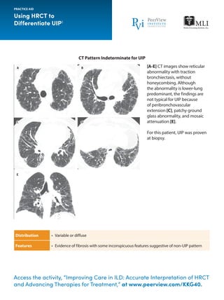 Improving Care in ILD: Accurate Interpretation of HRCT and Advancing ...
