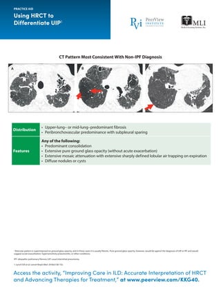 Improving Care in ILD: Accurate Interpretation of HRCT and Advancing ...