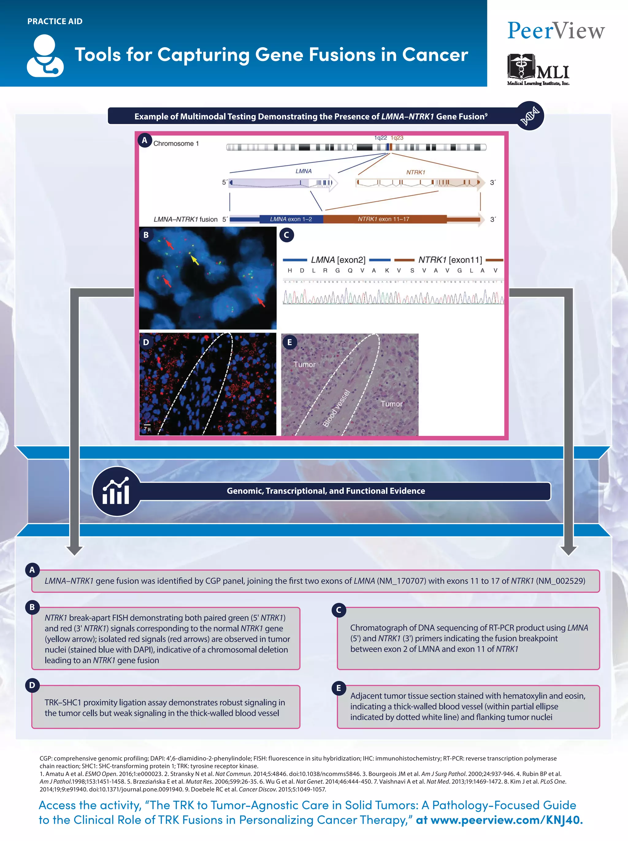 The TRK to Tumor-Agnostic Care in Solid Tumors: A Pathology-Focused ...