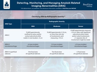 Improving the Recognition and Management of Amyloid-Related Imaging ...