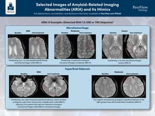 Alzheimer’s Disease Case Conference: Gearing Up for the Expanding Role ...