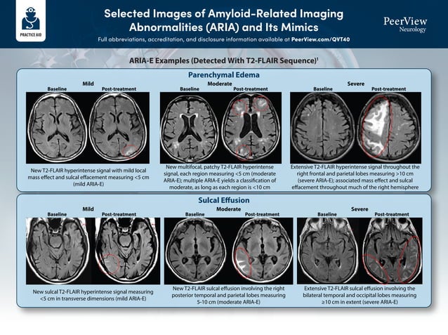 Case by Case: Actioning Patient-Centered Strategies for Risk Assessment ...