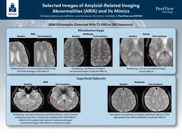 Case by Case: Actioning Patient-Centered Strategies for Risk Assessment ...