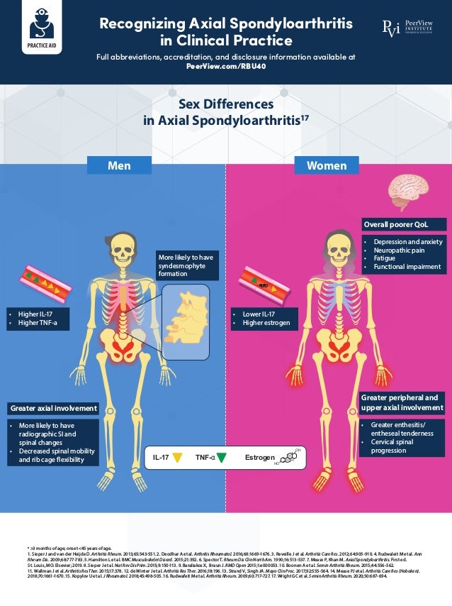 Recognition and Management of Axial Spondyloarthritis: Best Practices ...
