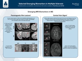 Taking a Closer Look at Each Patient: Exploring Novel Biomarker and ...