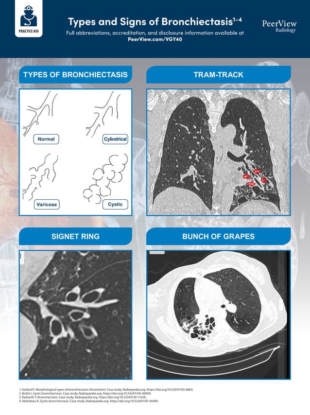 Bridging the Gap to Improved Outcomes in Non-Cystic Fibrosis ...