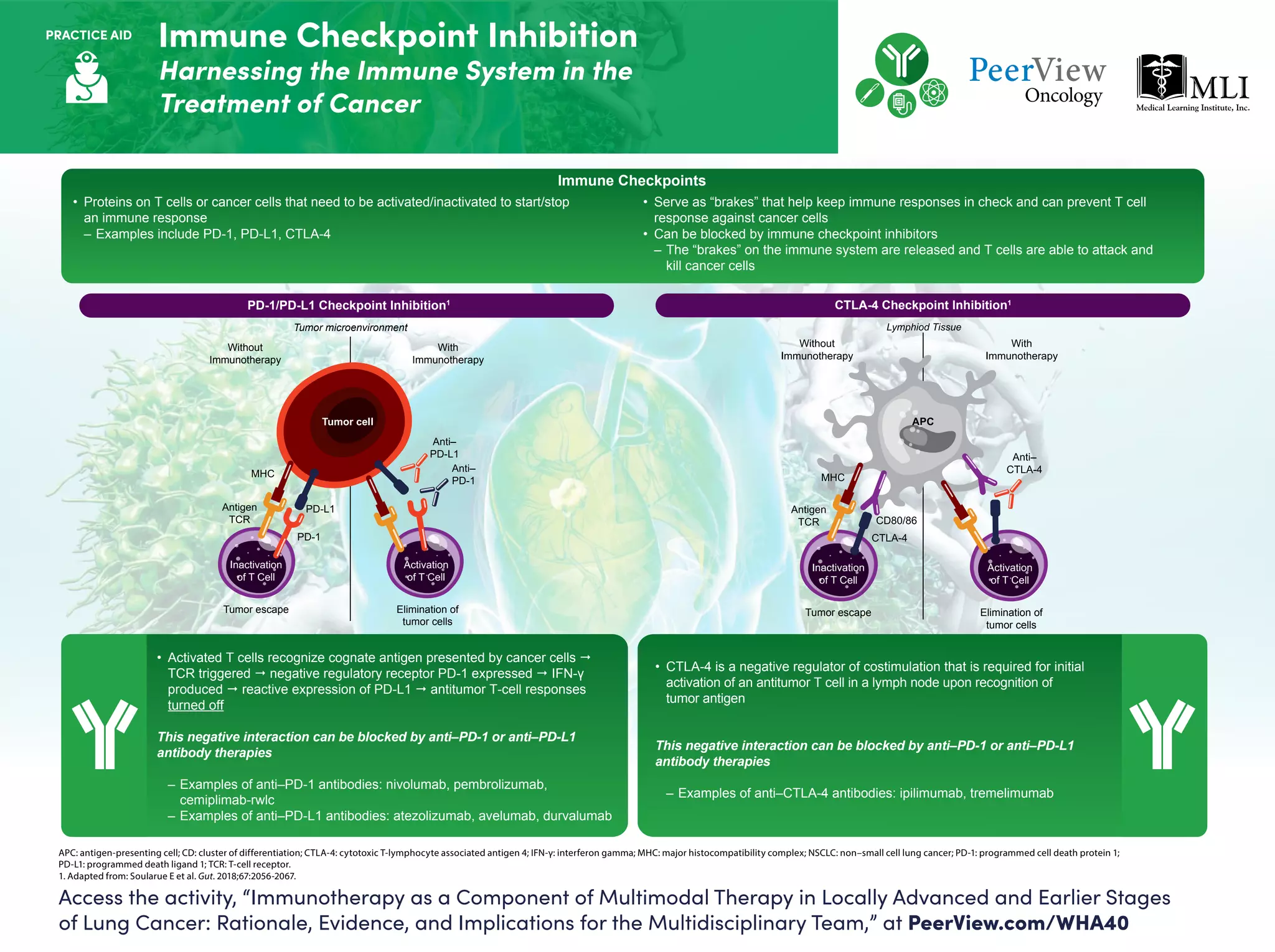 Immunotherapy as a Component of Multimodal Therapy in Locally Advanced ...