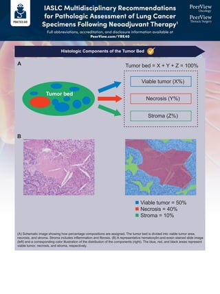 Realizing the Promise of Perioperative Immunotherapy in Resectable ...