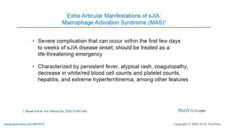Systemic Juvenile Idiopathic Arthritis: A Closer Look at the Burden on ...