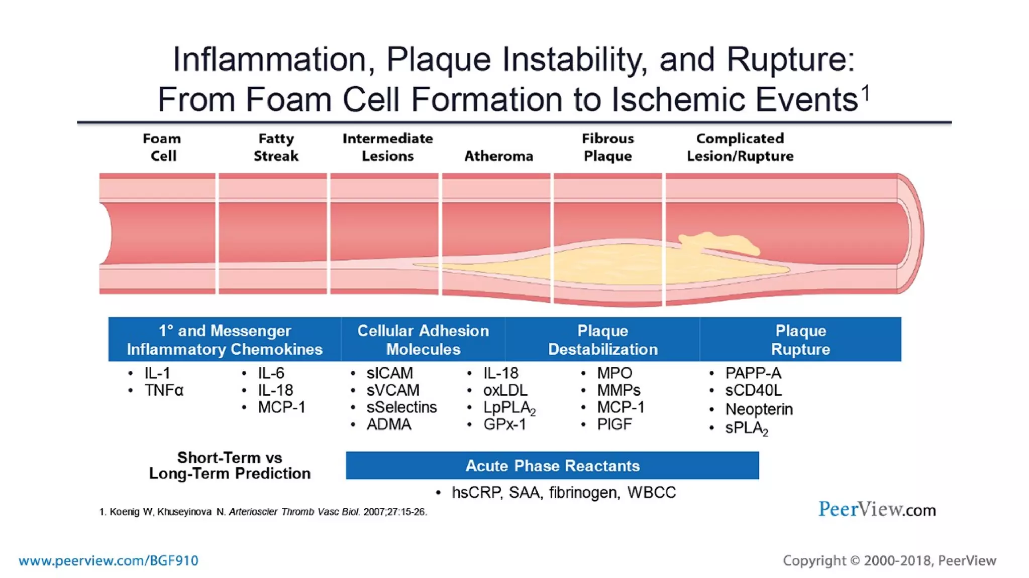 Looking Beyond Lipids: A Visual Guide to Targeting Vascular ...