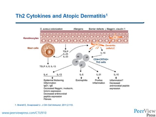 Insights Into the Pathophysiology of Atopic Dermatitis: Setting the ...
