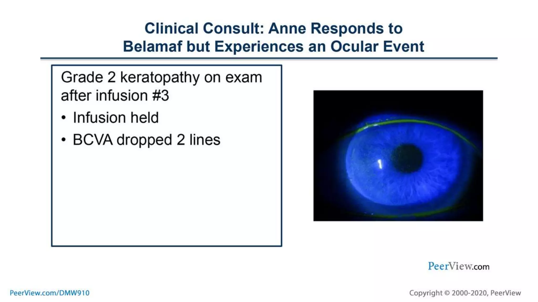 Targeting Ocular Toxicity in Multiple Myeloma: Opportunities for ...