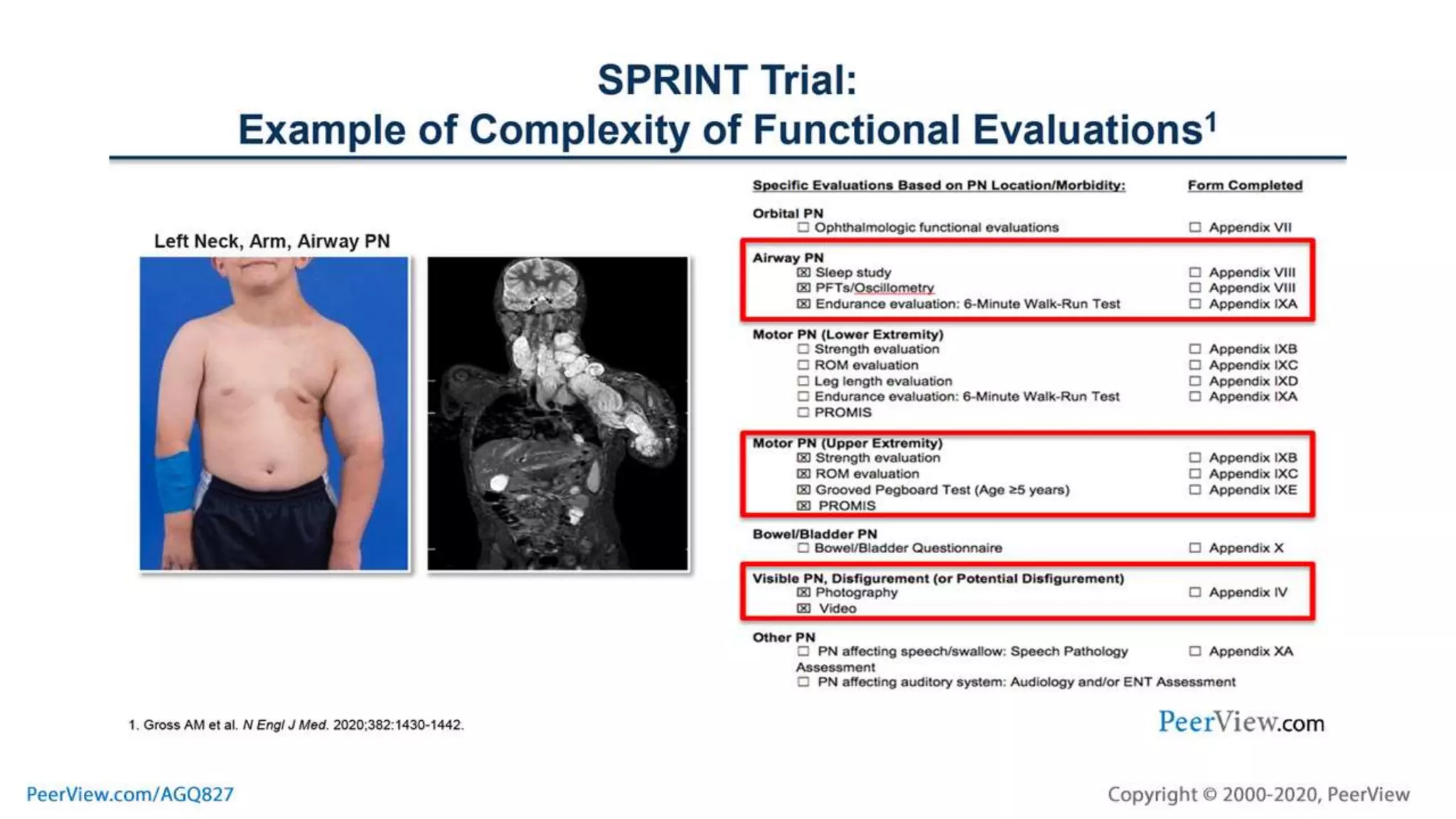 Progressive Pathways: Recent Recommendations and Emerging Therapies for ...