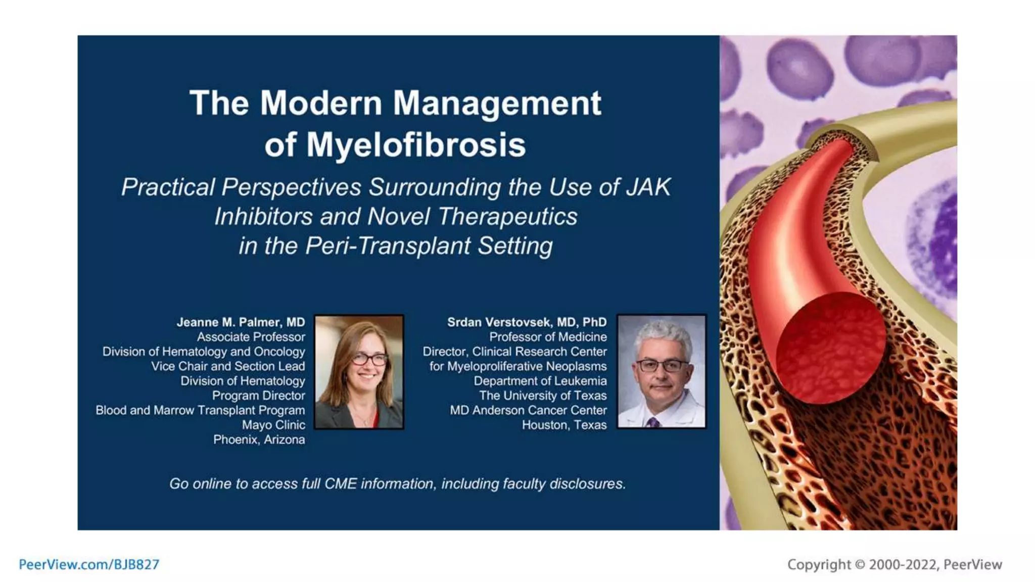 The Modern Management of Myelofibrosis: Practical Perspectives ...