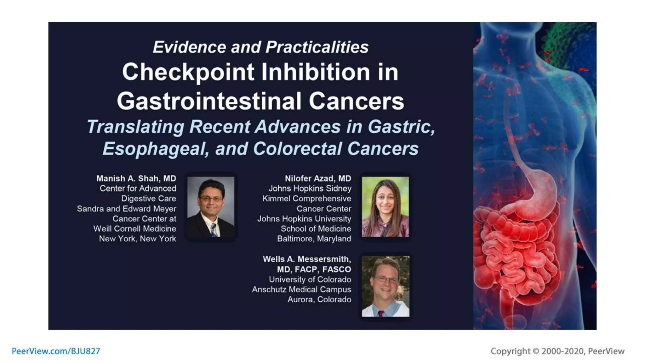 Evidence and Practicalities: Checkpoint Inhibition in Gastrointestinal ...