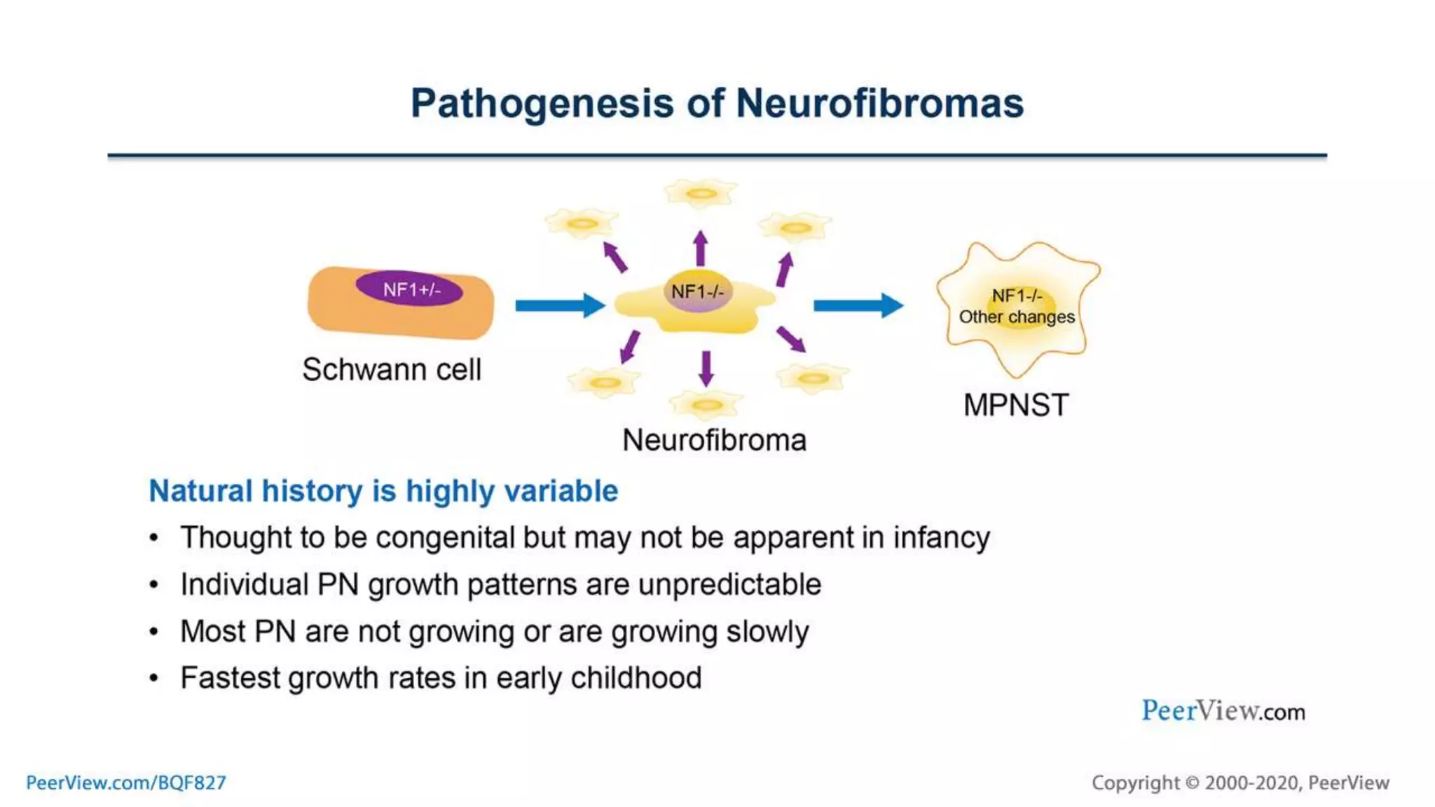 Targeting the RAS/MAPK Pathway in Neurofibromatosis Type 1, Plexiform ...
