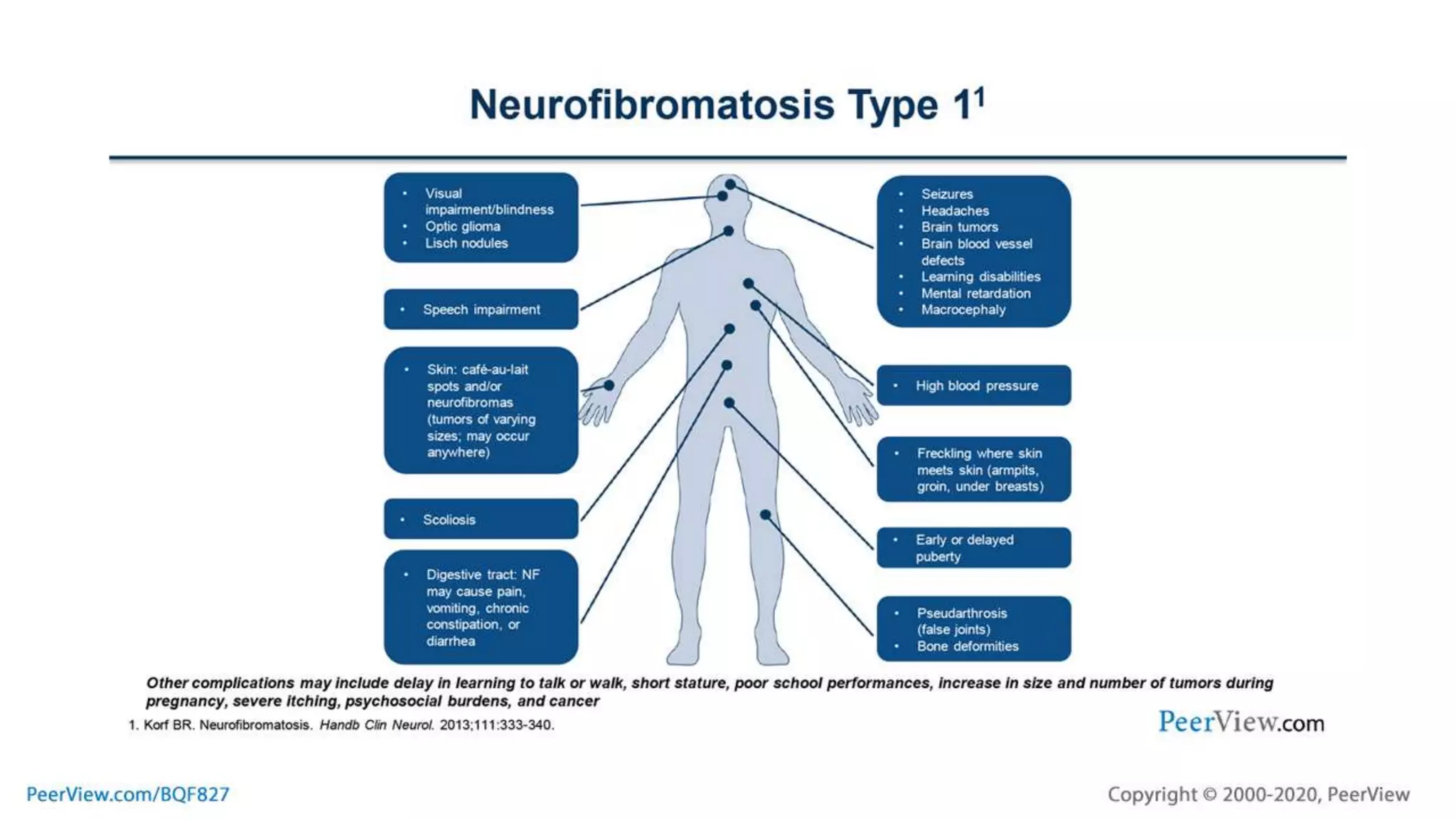 Targeting the RAS/MAPK Pathway in Neurofibromatosis Type 1, Plexiform ...