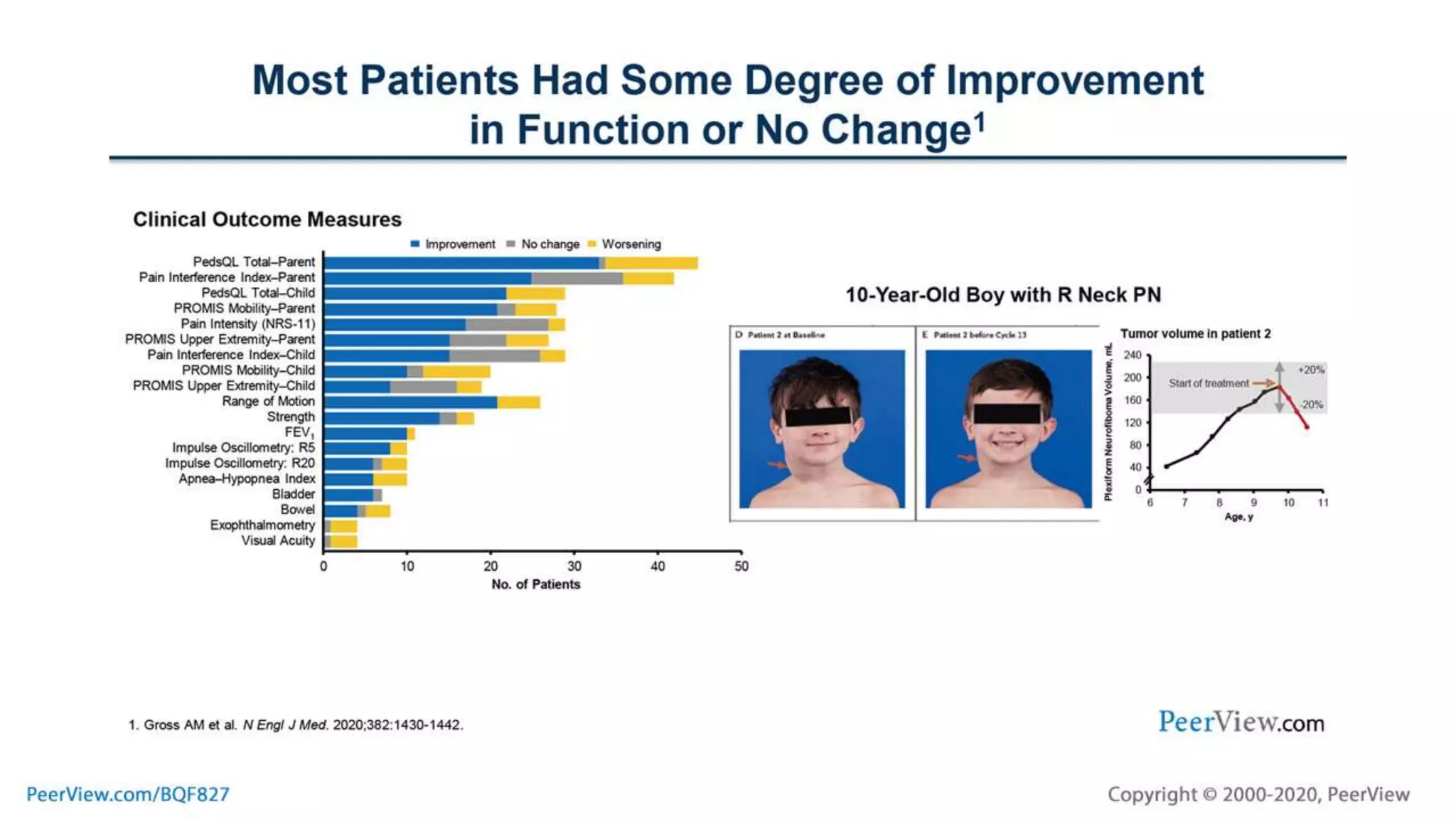 Targeting the RAS/MAPK Pathway in Neurofibromatosis Type 1, Plexiform ...