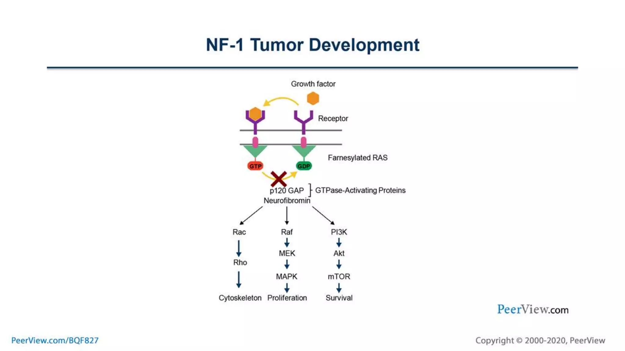 Targeting the RAS/MAPK Pathway in Neurofibromatosis Type 1, Plexiform ...