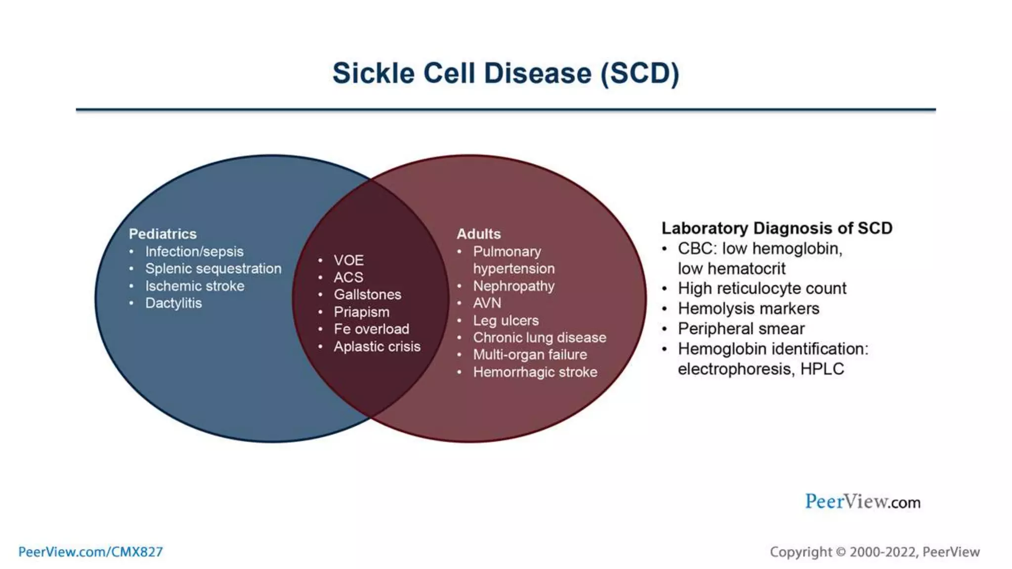 The Evolution of Sickle Cell Disease: Current Advances and Future ...