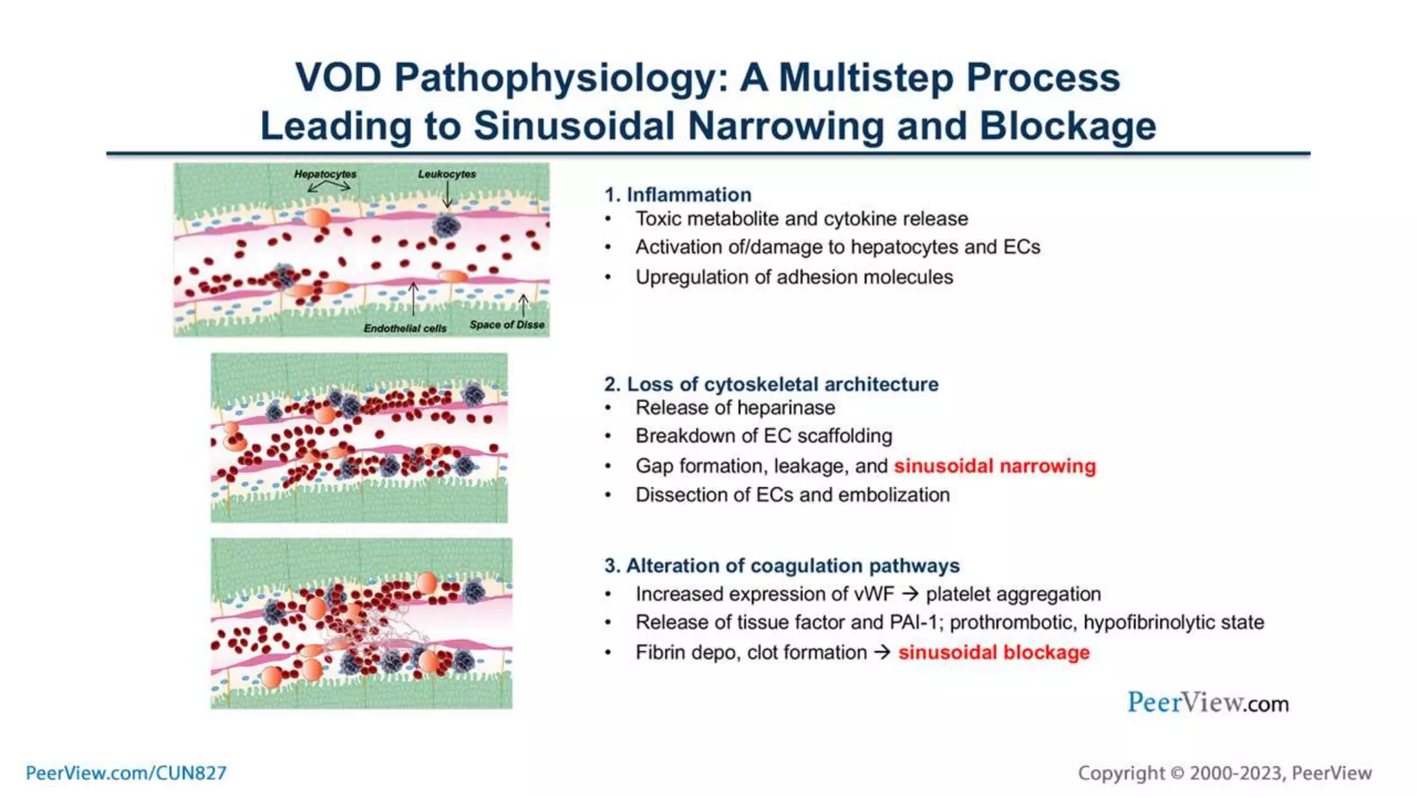 New Rules for VOD/SOS: Modern Risk Assessment, Diagnostic Principles ...