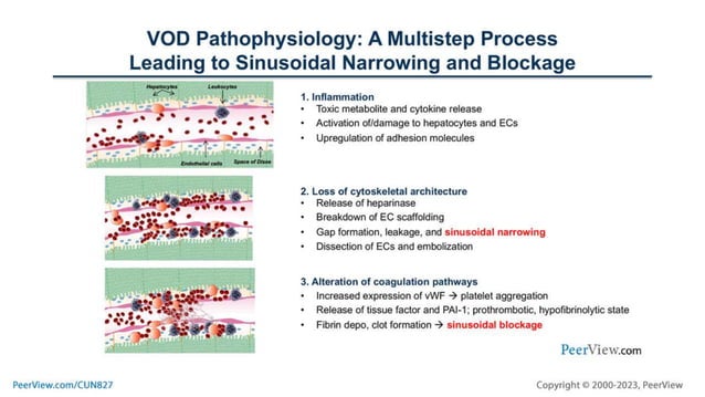 New Rules for VOD/SOS: Modern Risk Assessment, Diagnostic Principles ...