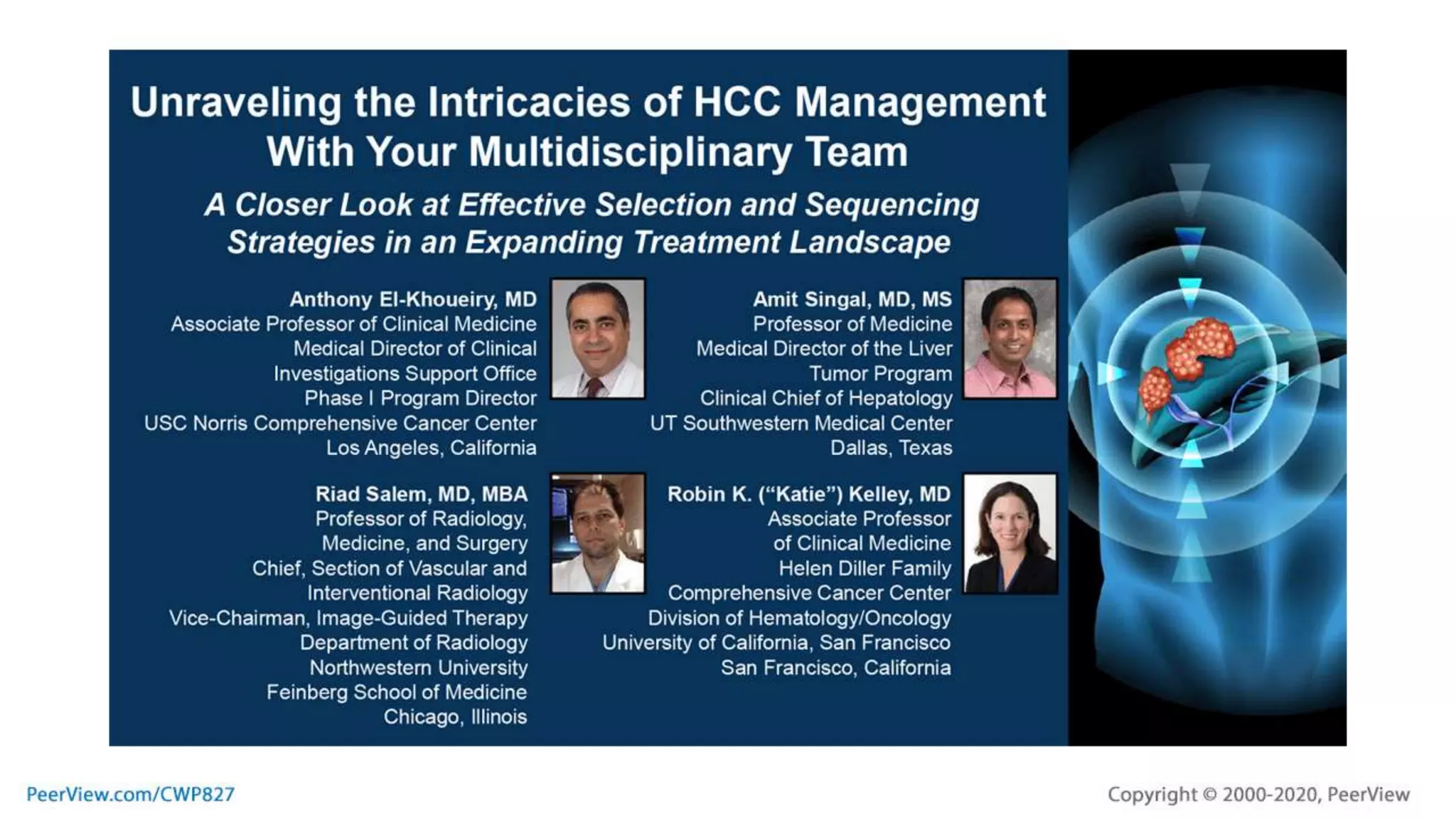 Unraveling the Intricacies of HCC Management With Your ...