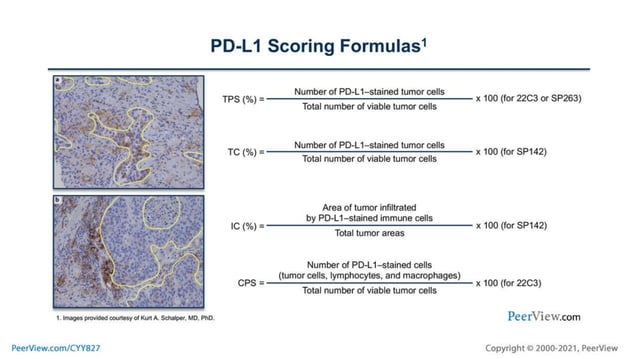 Revisiting PD-L1 as an Immunotherapy Biomarker Across the Cancer ...