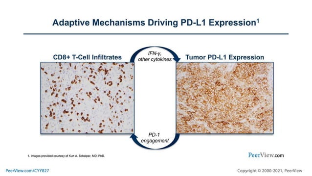 Revisiting PD-L1 as an Immunotherapy Biomarker Across the Cancer ...