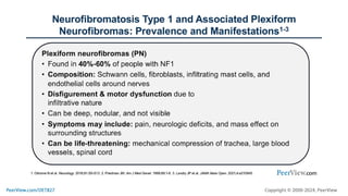 Mapping a New Treatment Journey in NF1: New Developments With MEKi for ...