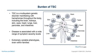 Applying Evidence to Practice: Updated Consensus Recommendations for ...