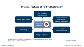 Finding the Path to Improved Recognition and Management of Tardive ...