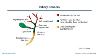 Prioritising Patient-Centric Care in Biliary Tract Cancer: Leveraging ...