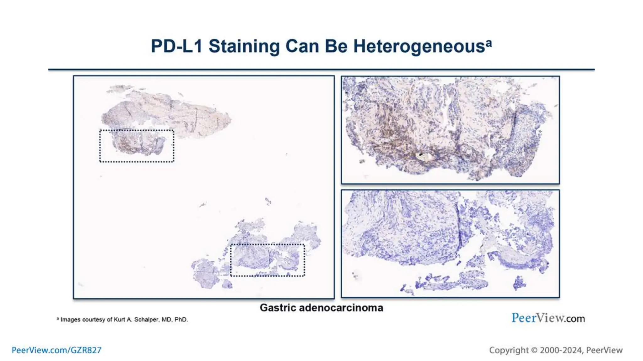 PATHway to Decoding the Impact of Cancer Immunotherapy: Latest Advances ...