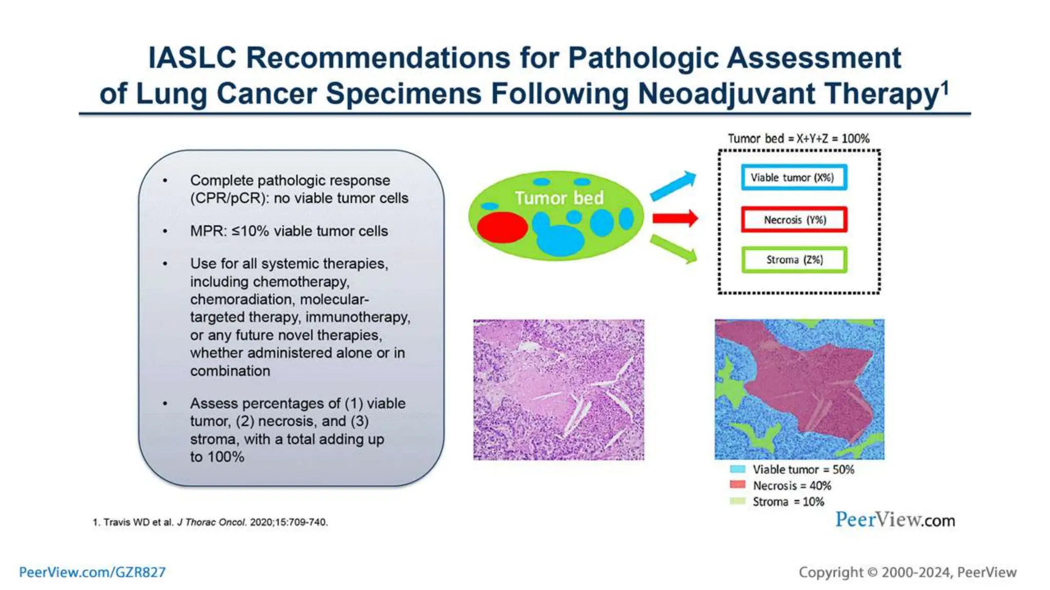 PATHway to Decoding the Impact of Cancer Immunotherapy: Latest Advances ...