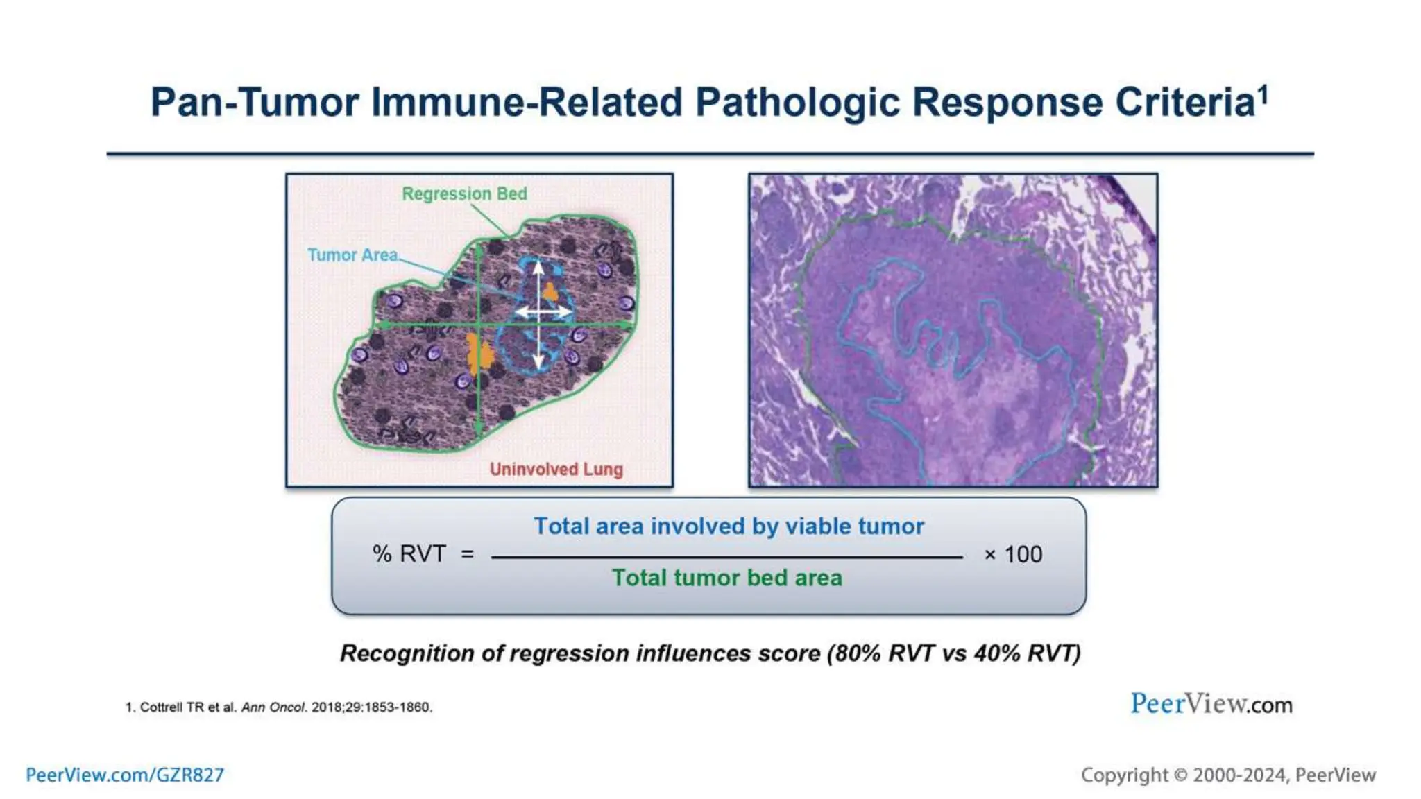 PATHway to Decoding the Impact of Cancer Immunotherapy: Latest Advances ...