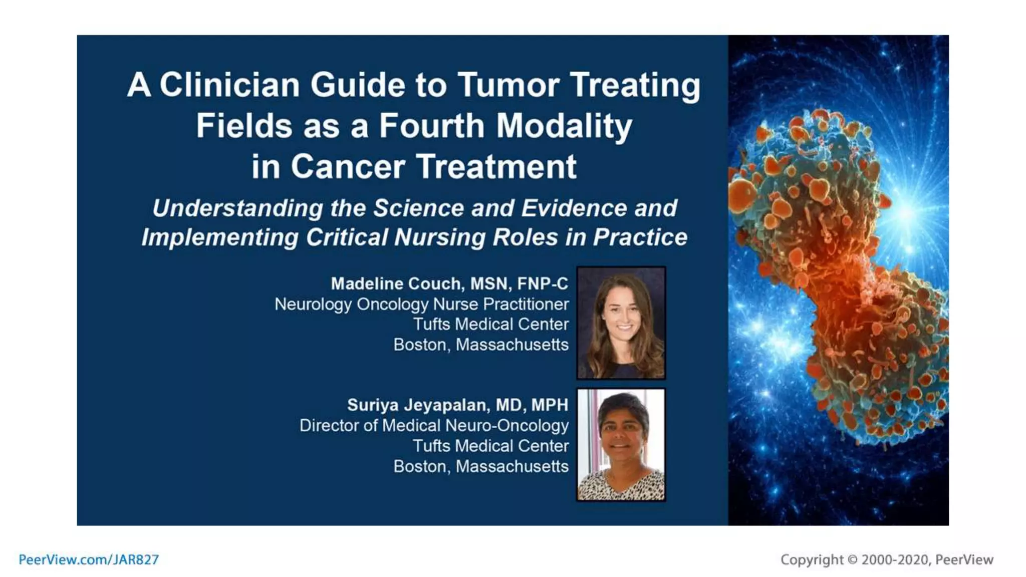 A Clinician Guide to Tumor Treating Fields as a Fourth Modality in ...