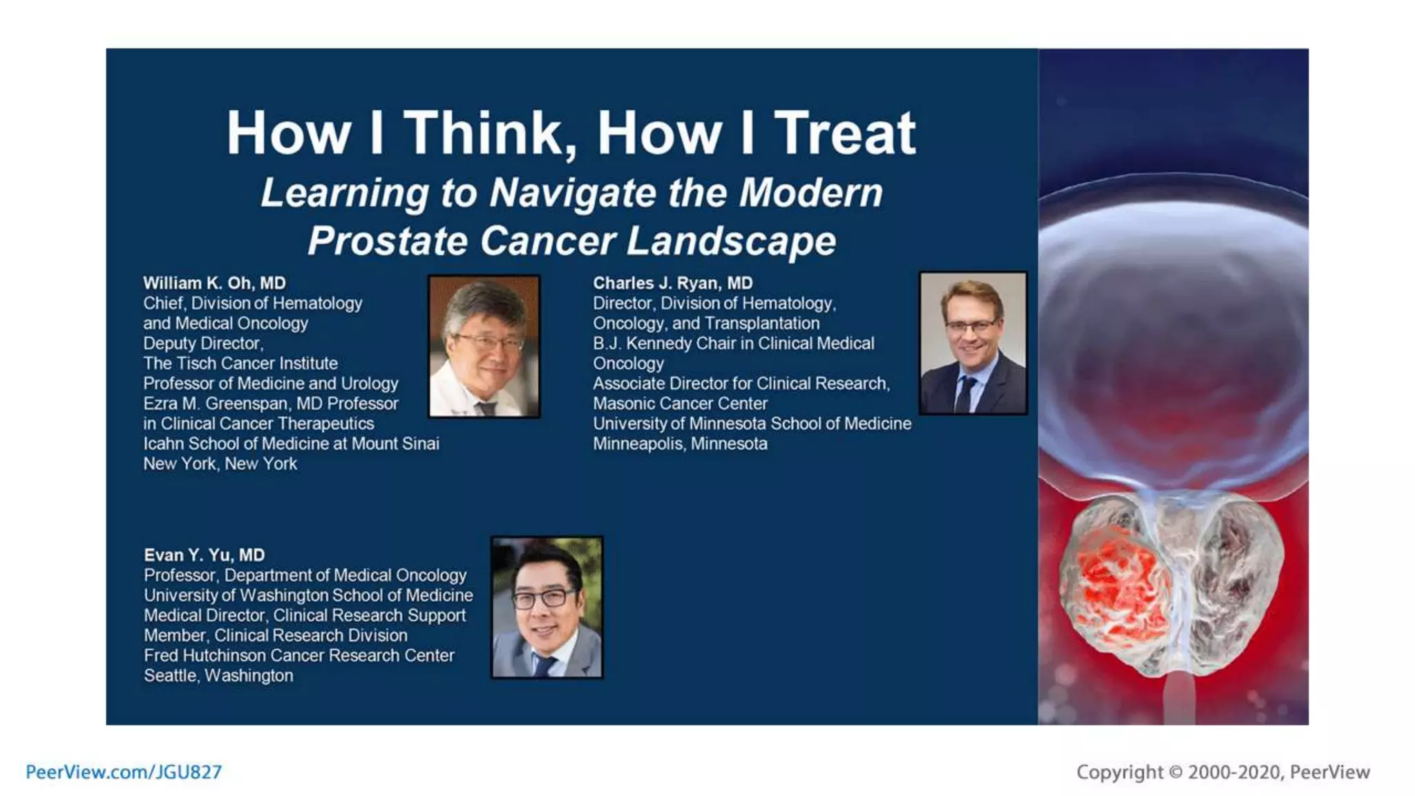 How I Think, How I Treat: Learning to Navigate the Modern Prostate ...
