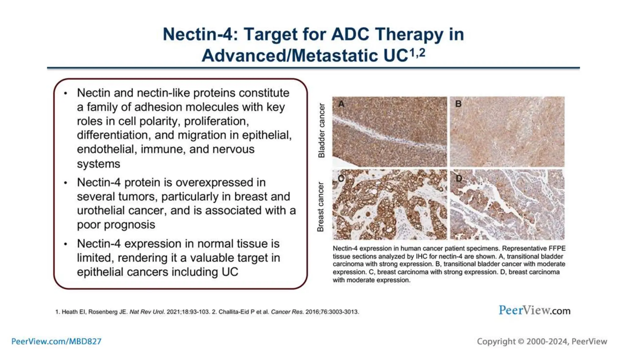 Maximizing the Role of ADCs in Urothelial Carcinoma: Practical Tips for ...