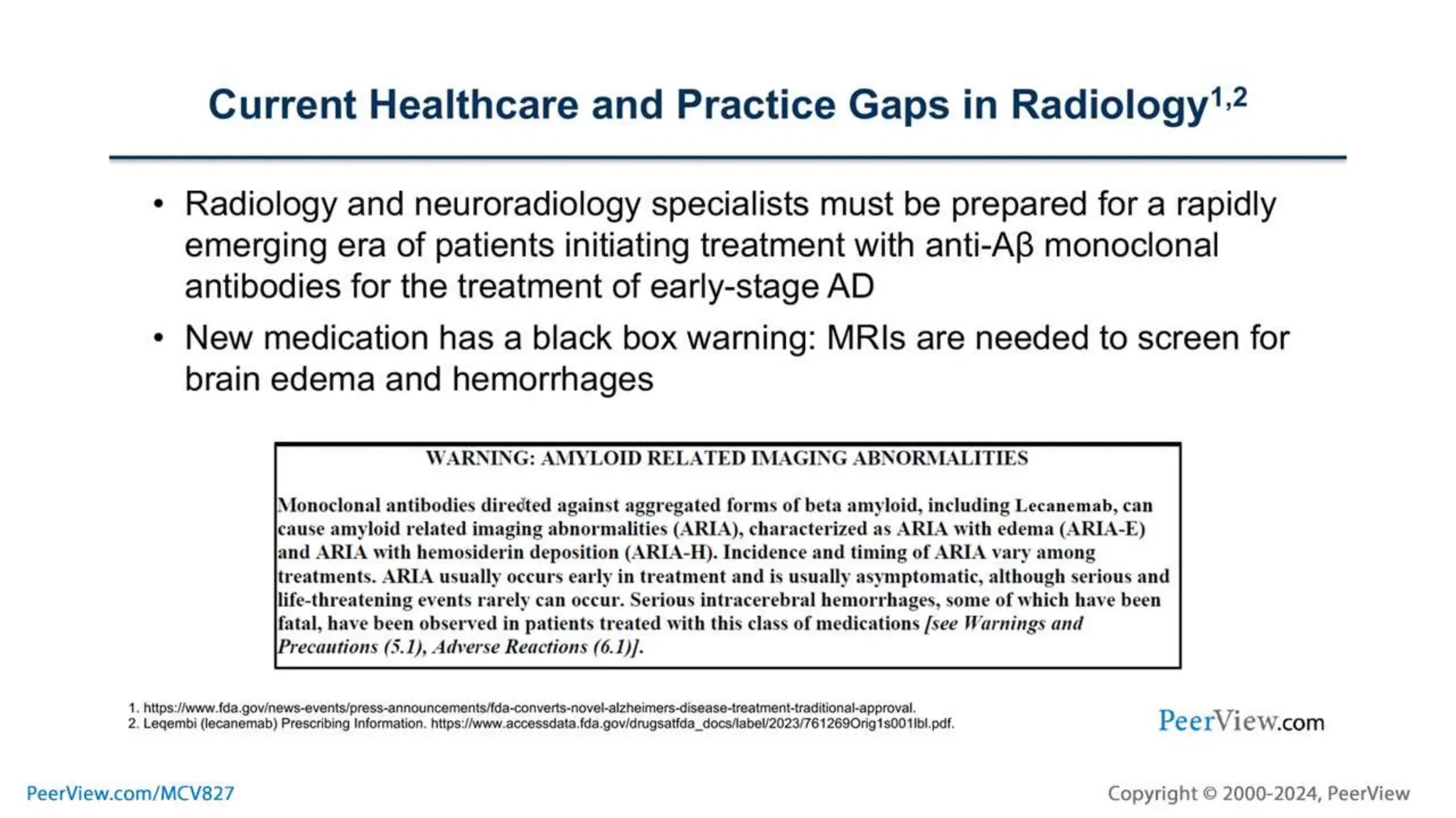Improving the Recognition and Management of Amyloid-Related Imaging ...