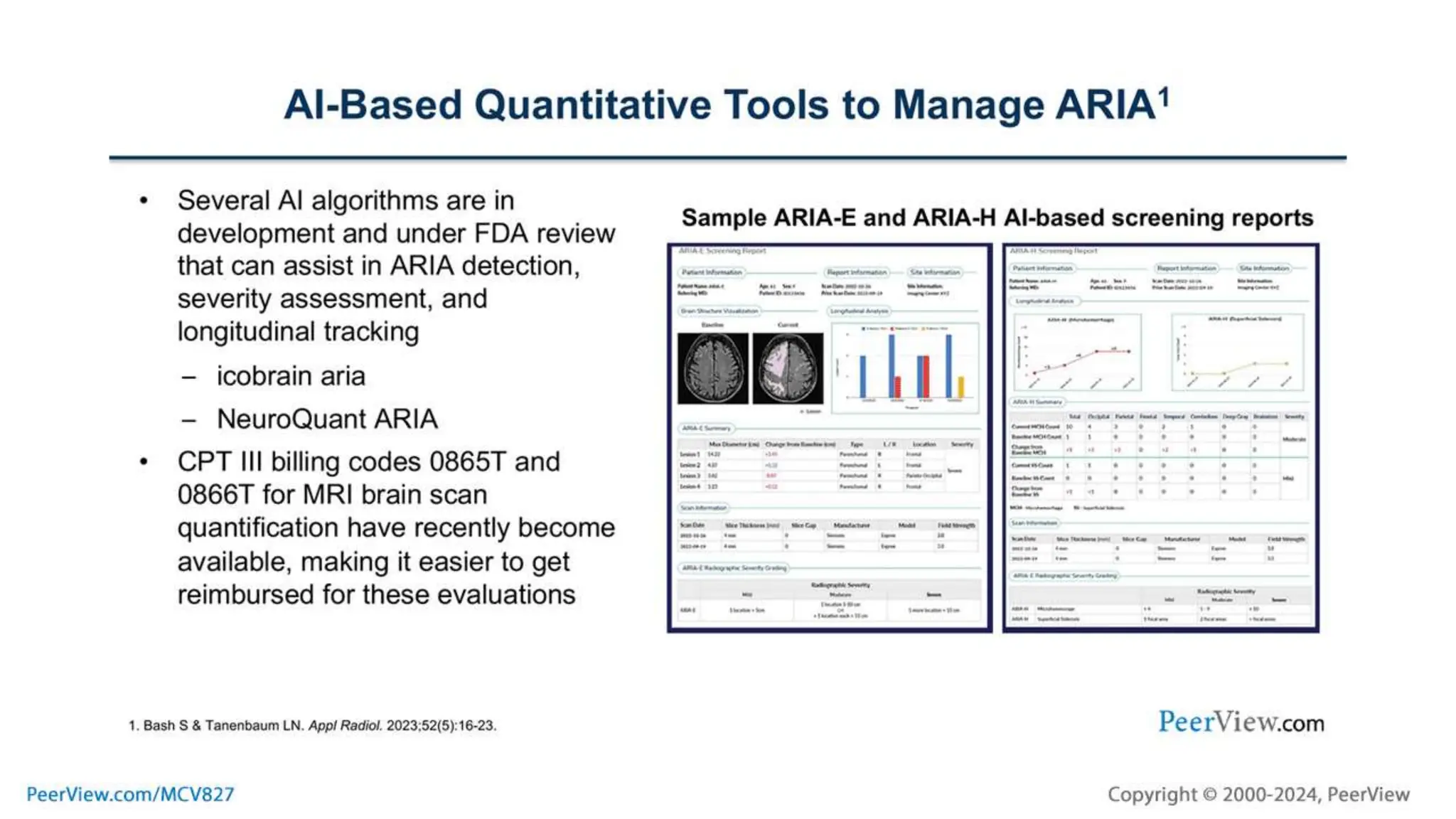 Improving the Recognition and Management of Amyloid-Related Imaging ...