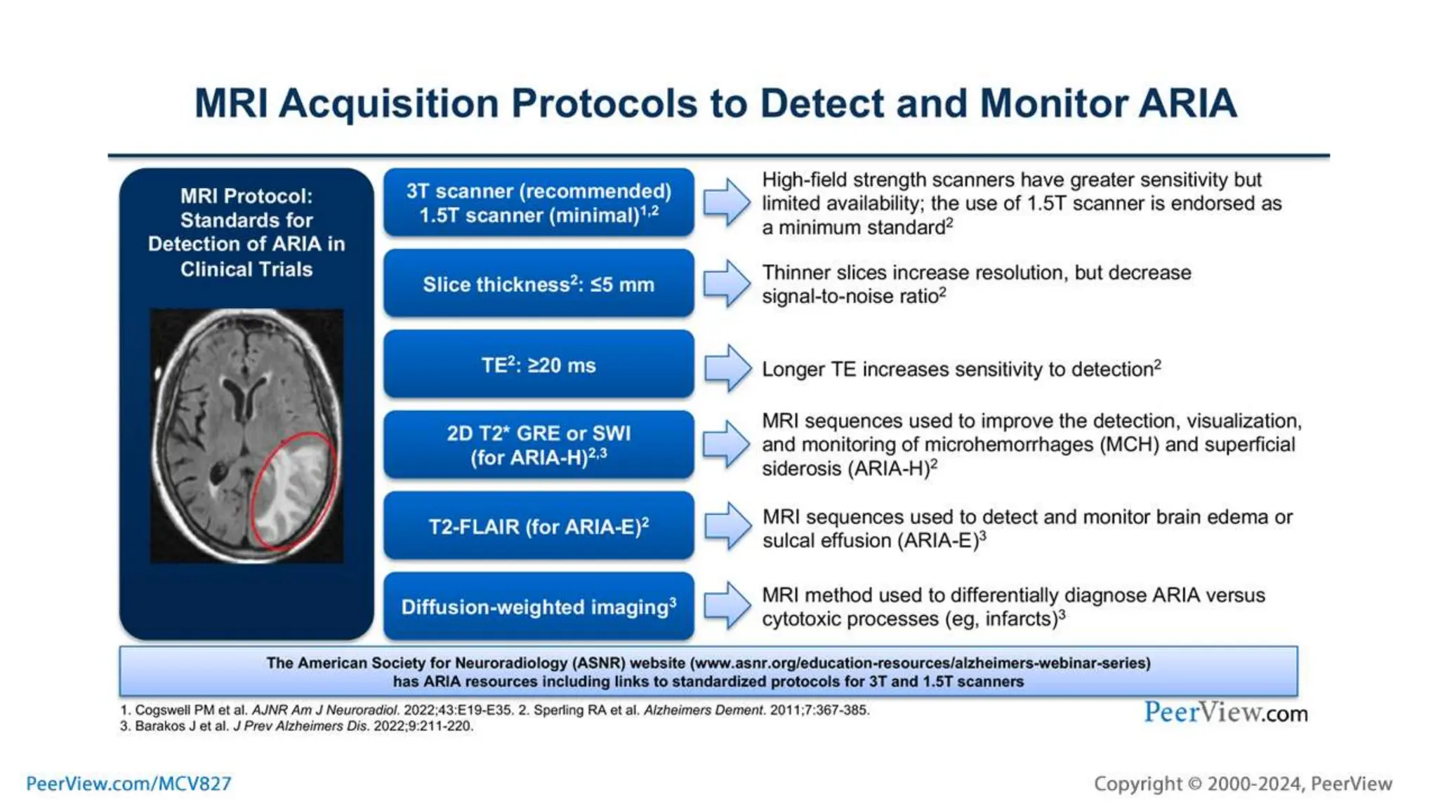 Improving the Recognition and Management of Amyloid-Related Imaging Abnormalities (ARIA) in ...