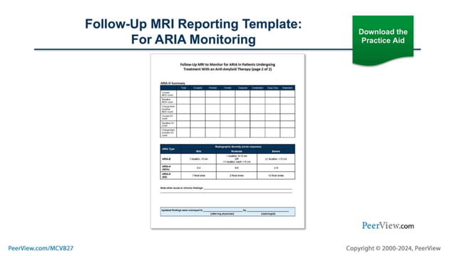 Improving the Recognition and Management of Amyloid-Related Imaging ...