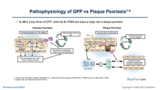 Novel Targets for Management of Generalized Pustular Psoriasis ...
