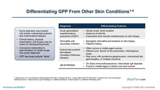Novel Targets for Management of Generalized Pustular Psoriasis ...