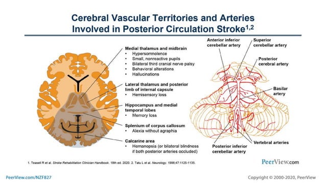 Not So FAST: Improving the Diagnosis and Treatment of Posterior ...