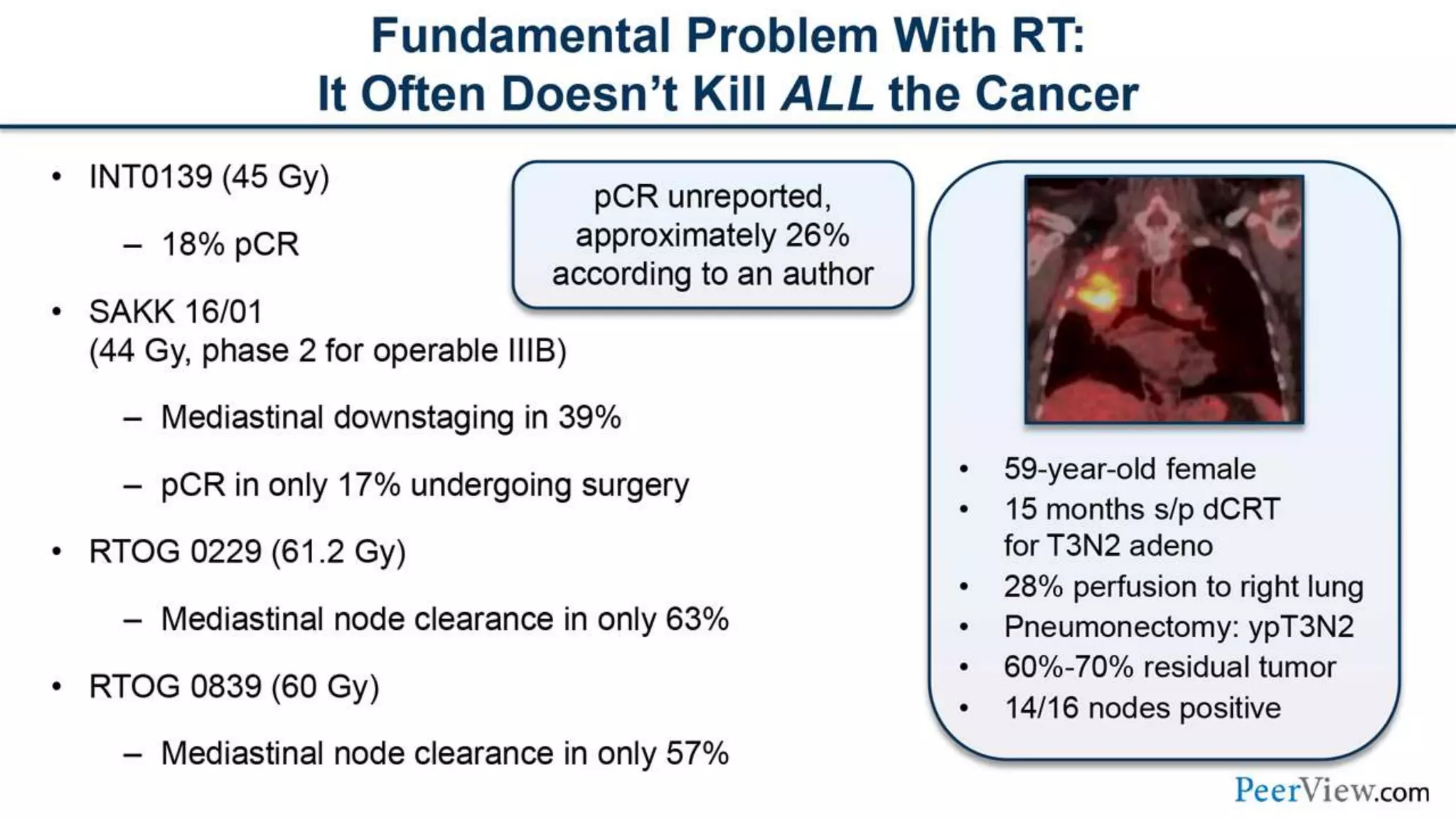Immunotherapy as a Game-Changer in Multimodal Management of Locally ...