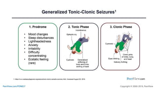 Generalized Tonic-Clonic Seizures: Clinical Pearls for Recognition and Optimal Management. | PPT