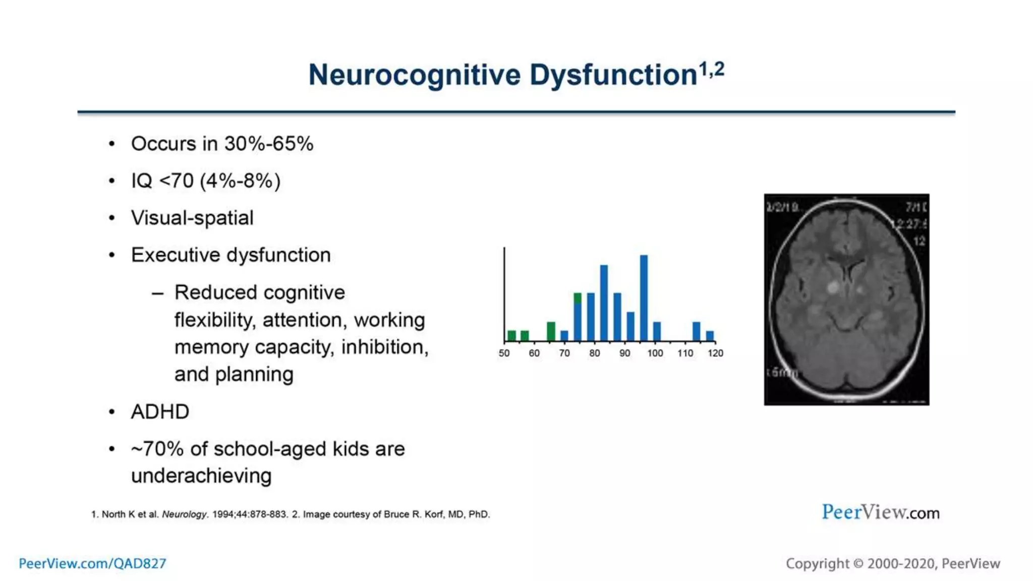 Targeting the RAS/MAPK Pathway in Neurofibromatosis Type 1 and ...